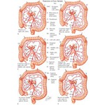 Blood Supply of the Large Intestine (Continued): Variations In Colic ...