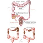 Motility of the Large Intestine