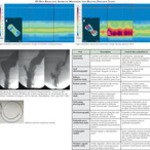 Motility Testing: 3D High Resolution Anorectal Manometry with Balloon ...