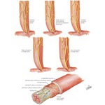 Intrinsic Nerves and Variations in Nerves of Esophagus