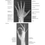 Wrist and Hand: Radiographs